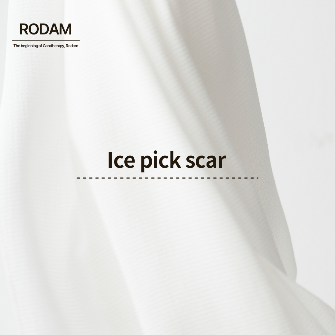 Ice pick scars refer to pitted scars caused by acne. Coratherapy ...