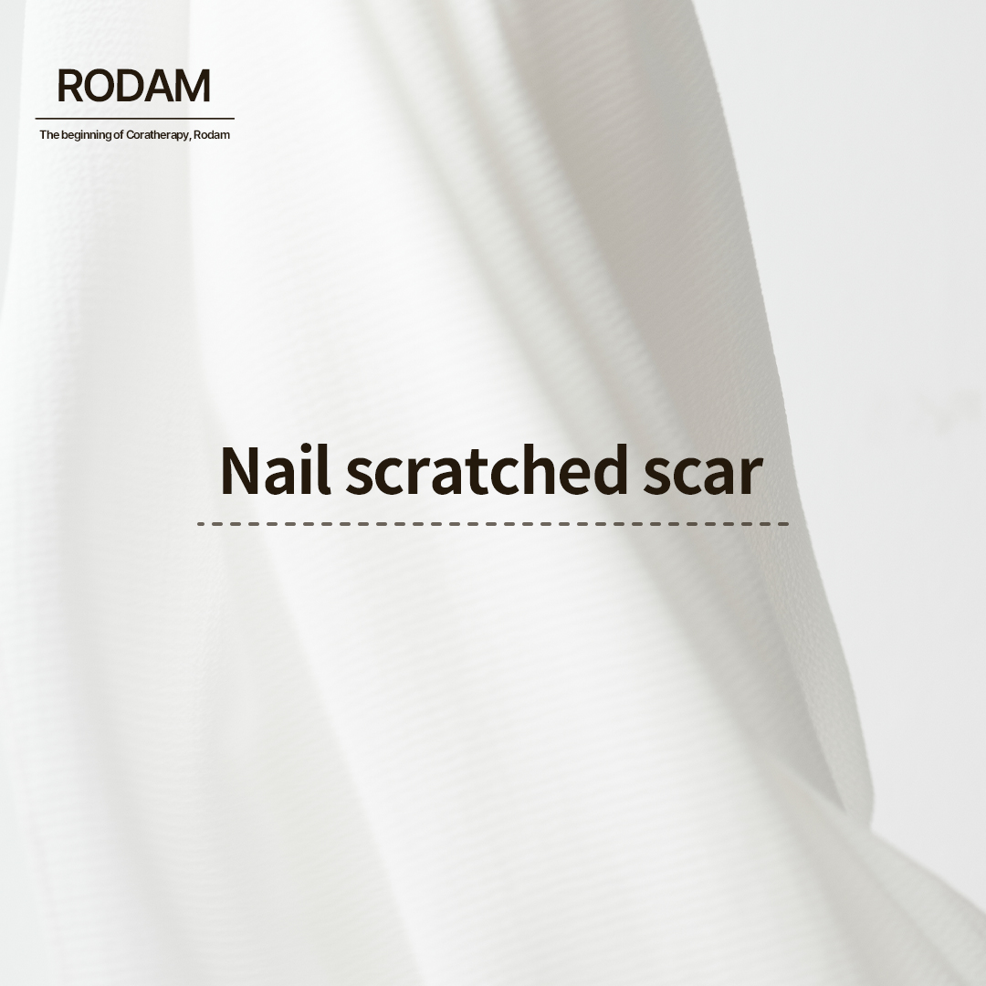 Treatment of Old Nail Scars at Rodam Korean Medicine Clinic with ...